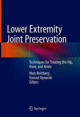 【预订】Lower Extremity Joint Preservation