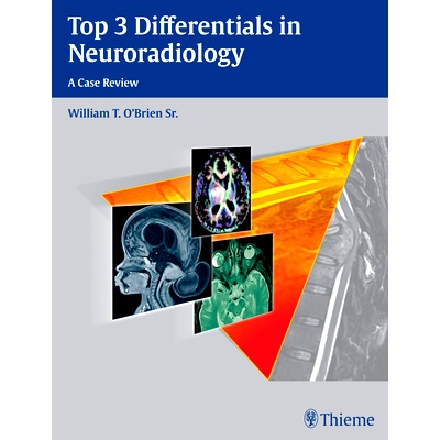 预订 Top 3 Differentials in Neuroradiology 神经放射学3大差距: 9781604067231