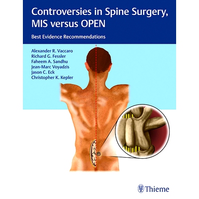 预订 Controversies in Spine Surgery, MIS versus OPEN: Best Evidence Recommendations 脊柱手术中的争议，MIS 与 OPEN: 97816