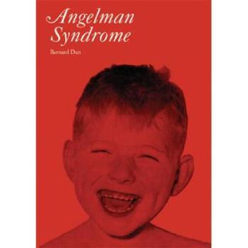 【预订】Angelman’S Syndrome
