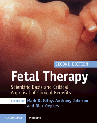 【预订】Fetal Therapy