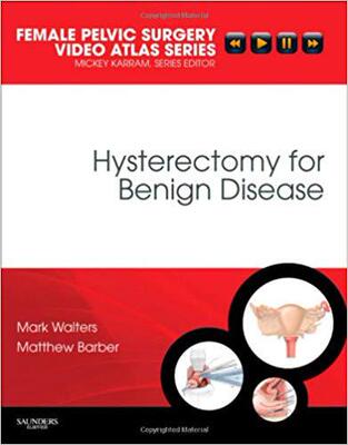 【预订】Hysterectomy for Benign Disease