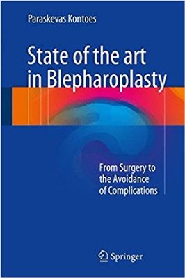 【预订】State of the art in Blepharoplasty