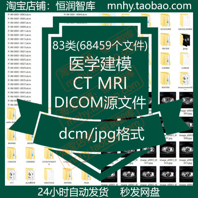 医学建模CT MRI DICOM数据dcm源文件股骨骨盆脊柱颈椎胸椎膝关节