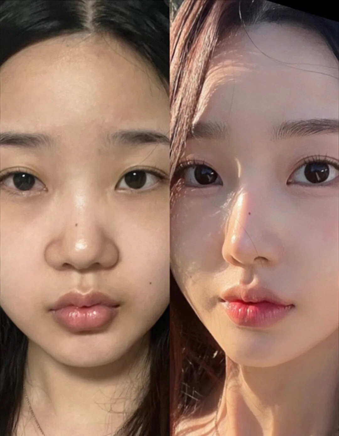 草本鼻尖肥大圆钝修复的精华 缩鼻美鼻立体鼻部精油