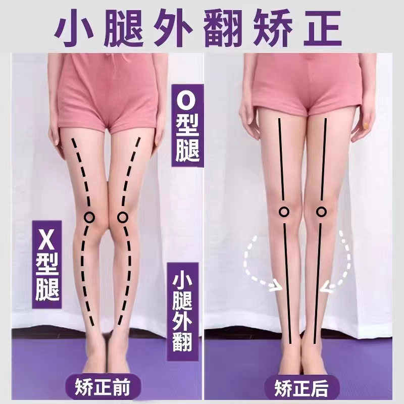 小腿外翻矫正修复 改善O型腿八字型腿扁平足小腿外翻足弓塌陷天然