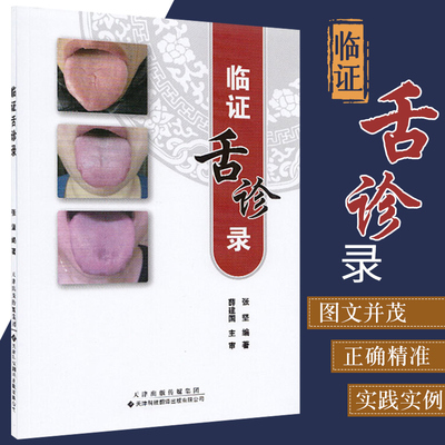临证舌诊录 张坚编著 舌诊书图解舌诊精准辨证与开方入门图谱教程中医养生书籍舌像舌苔辨析临床病症望舌诊病舌诊入门与临证