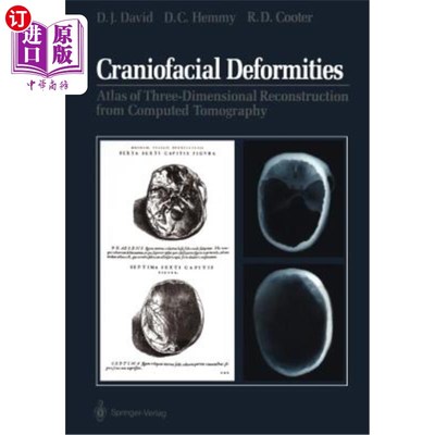 海外直订医药图书Craniofacial Deformities: Atlas of Three-Dimensional Reconstruction from Compute 颅面畸形:计算机断
