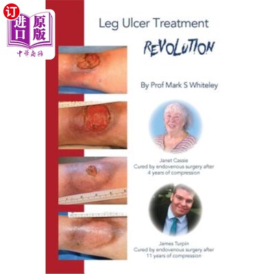 海外直订医药图书Leg Ulcer Treatment Revolution 腿部溃疡的治疗革命