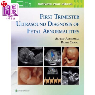 海外直订医药图书First Trimester Ultrasound Diagnosis of Fetal Abnormalities 胎儿畸形的前三个月超声诊断