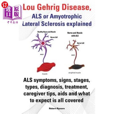 海外直订医药图书Lou Gehrig Disease, ALS or Amyotrophic Lateral Sclerosis Explained. ALS Symptoms 娄氏病，肌萎缩侧索