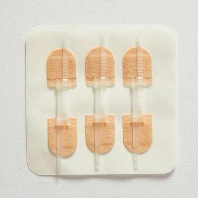Band-Aid Zipper Tie Wound Closure Patch Hemostatic Patch Wou