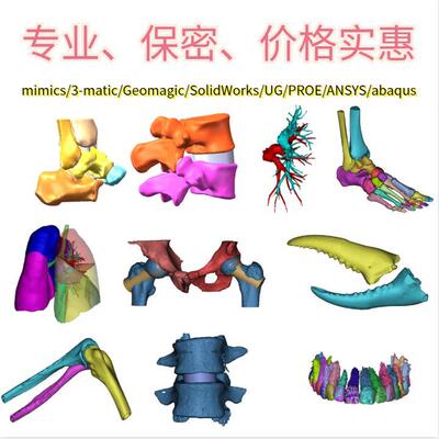CT重建 医学有限元 mimics代做 3-matic ANSYS 骨骼建模 有限元