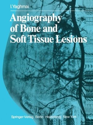 【预订】Angiography of Bone and Soft Tissue ...