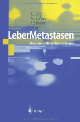 【预订】Lebermetastasen: Diagnose Interventi...
