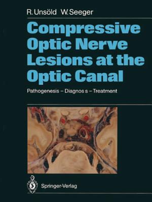 【预订】Compressive Optic Nerve Lesions at t...