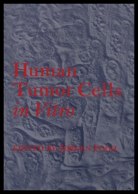 【预售】Human Tumor Cells in Vitro