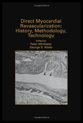 【预售】Direct Myocardial Revascularization: History, Met