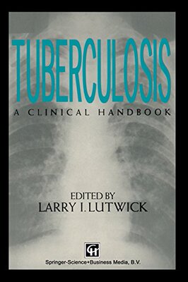 【预订】Tuberculosis
