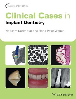 【预订】Clinical Cases in Implant Dentistry...
