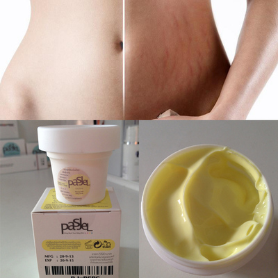cream for stch marks and scar removal powerful to stch