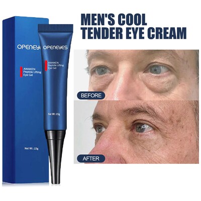 Anti Aging Eye Cream Reduces Eye Wrinkles Retinol Anti