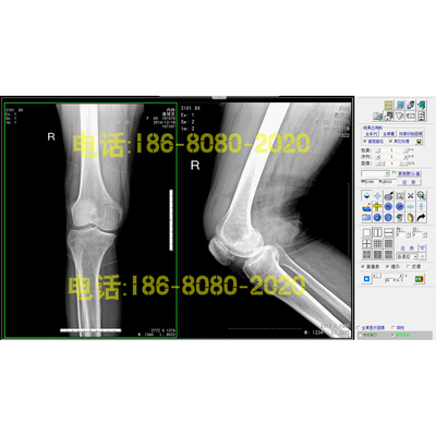 DR工作站软件DR软件CR工作站软件CR软件放射科pacs软件