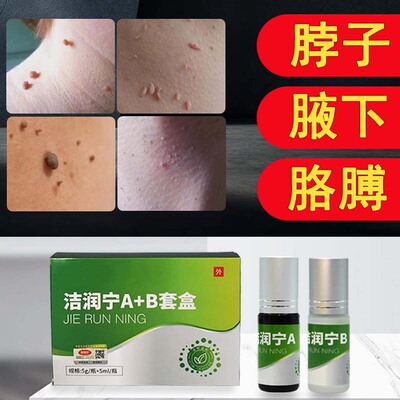 脖子腋下长的小点膏净去掉除神器