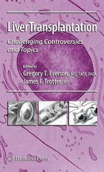 【预售】Liver Transplantation: Challenging Controversies and