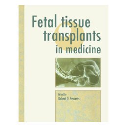 【预售】Fetal Tissue Transplants in Medicine