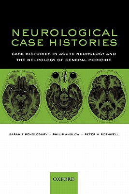 【预售】Neurological Case Histories: Case Histories in Acute