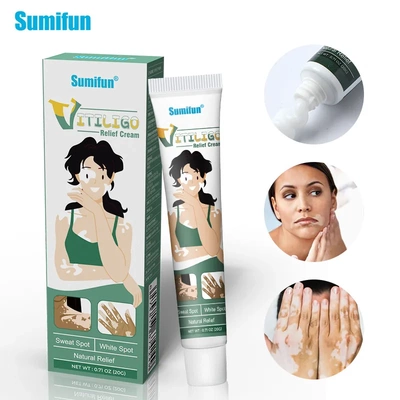 sumifun 跨境电商速卖通亚马逊temu 白斑膏 皮肤护理乳膏 K10109