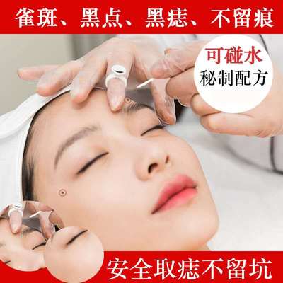 取痣黑点药水无痕正品黑痣去痦子点斑膏雀斑去斑脸部痣修复神器笔