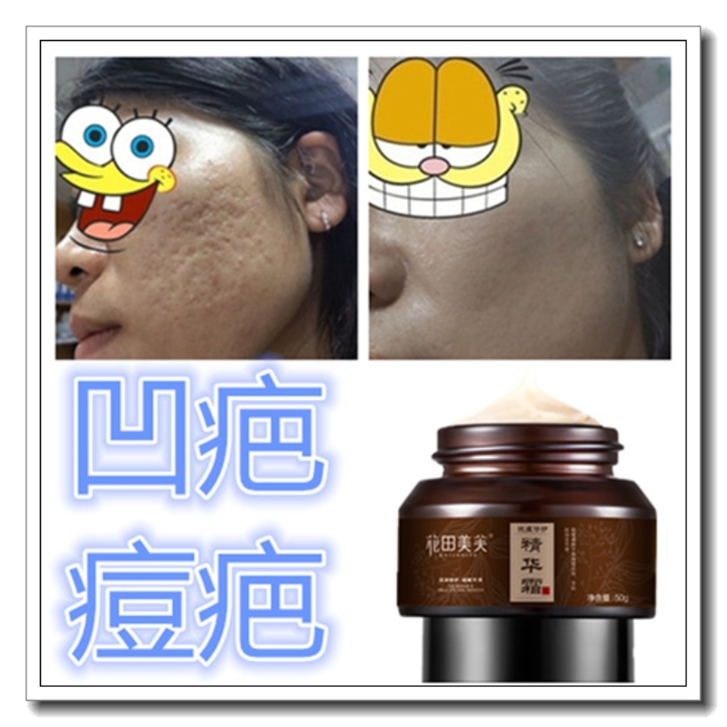 正品草本祛凹陷凹坑痘疤痕灵膏祛豆印霜抚平痘坑修复毛孔粗大产品