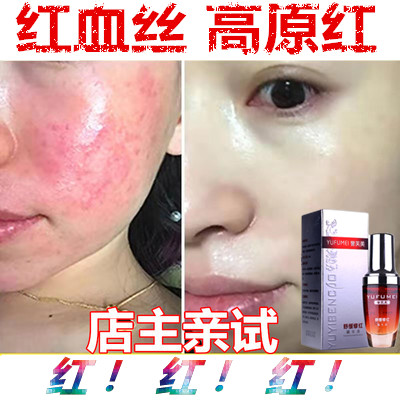 保湿祛红血丝补水原液淡化正品修复增厚角质层薄男女褪红护肤产品