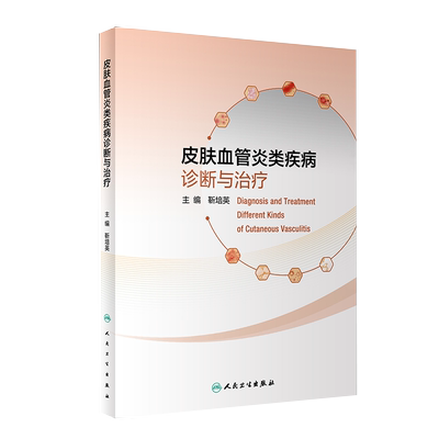 皮肤血管炎类疾病诊断与治疗人卫