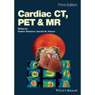 按需印刷Cardiac CT, PET and MR[9781118754504]