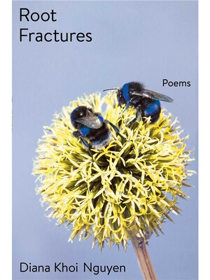 预售【2024新书】Root Fractures