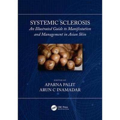按需印刷Systemic Sclerosis:An Illustrated Guide to Manifestation and Management in Asian Skin[9781138480049]