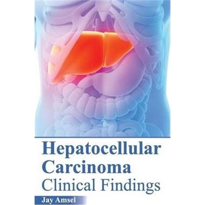 按需印刷Hepatocellular Carcinoma[9781632422286]