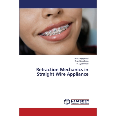 按需印刷不退不换Retraction Mechanics in Straight Wire Appliance[9783659683251]