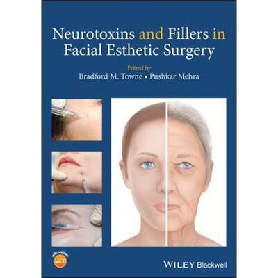 按需印刷不退不换Neurotoxins and Fillers in Facial Esthetic Surgery[9781119294276]