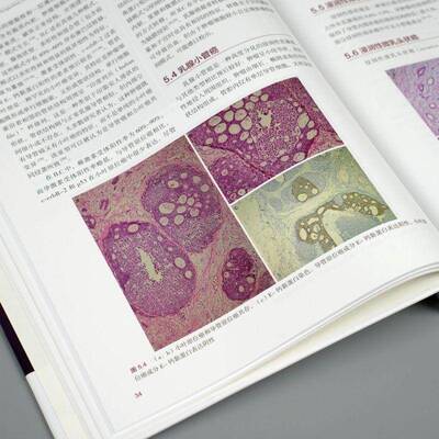 乳腺癌精要:外科观点:perspectives for surgeons世界图书出版西安