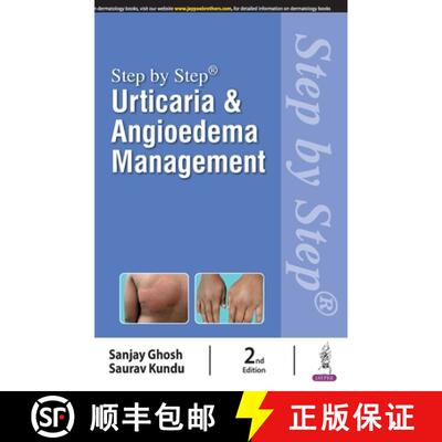 【3-4周达】Step by Step: Urticaria & Angioedema Management [9789356969827]