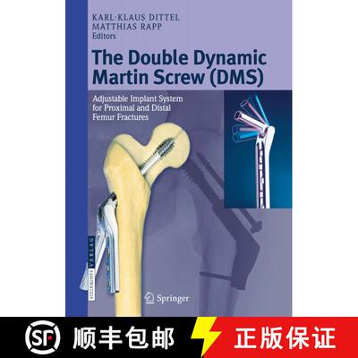 【3-4周达】The Double Dynamic Martin Screw (DMS) : Adjustable Implant System for Proximal and Distal ... [9783662526880]