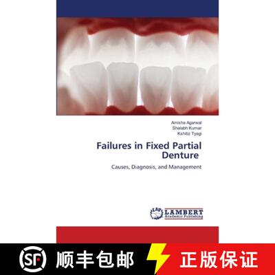 预订 Failures in Fixed Partial Denture: Causes, Diagnosis, and Management (Aufl.) [9786209967238]