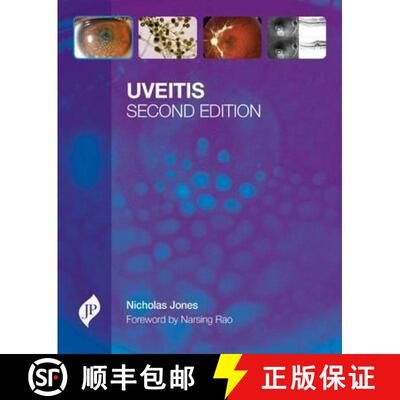 【3-4周达】Uveitis (Revised) [9781907816185]