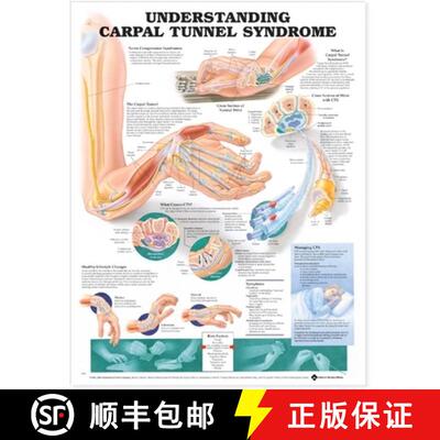 【3-4周达】Understanding Carpal Tunnel Syndrome Anatomical Chart [9781587793219]