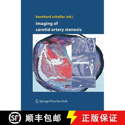 【3-4周达】Imaging of Carotid Artery Stenosis [9783709117415]