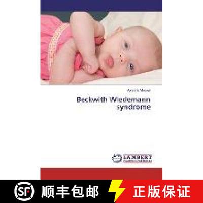 预订 Beckwith Wiedemann syndrome [9783330007598]
